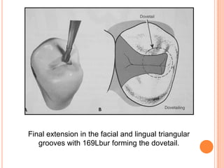 Cast gold Inlay restorations | PPTX