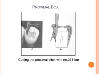 Cast gold Inlay restorations | PPTX