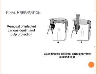 Cast gold Inlay restorations | PPTX