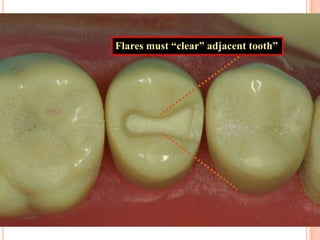 Cast gold Inlay restorations | PPTX