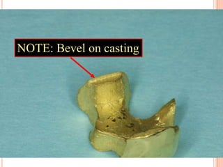 Cast gold Inlay restorations | PPTX