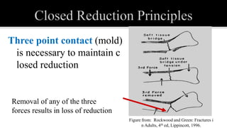 Cast index re | PPTX
