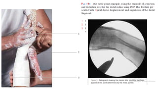 Cast index re | PPTX