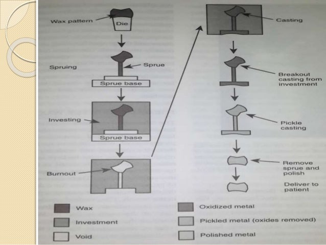 Casting in dentistry