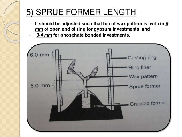 Casting in dentistry
