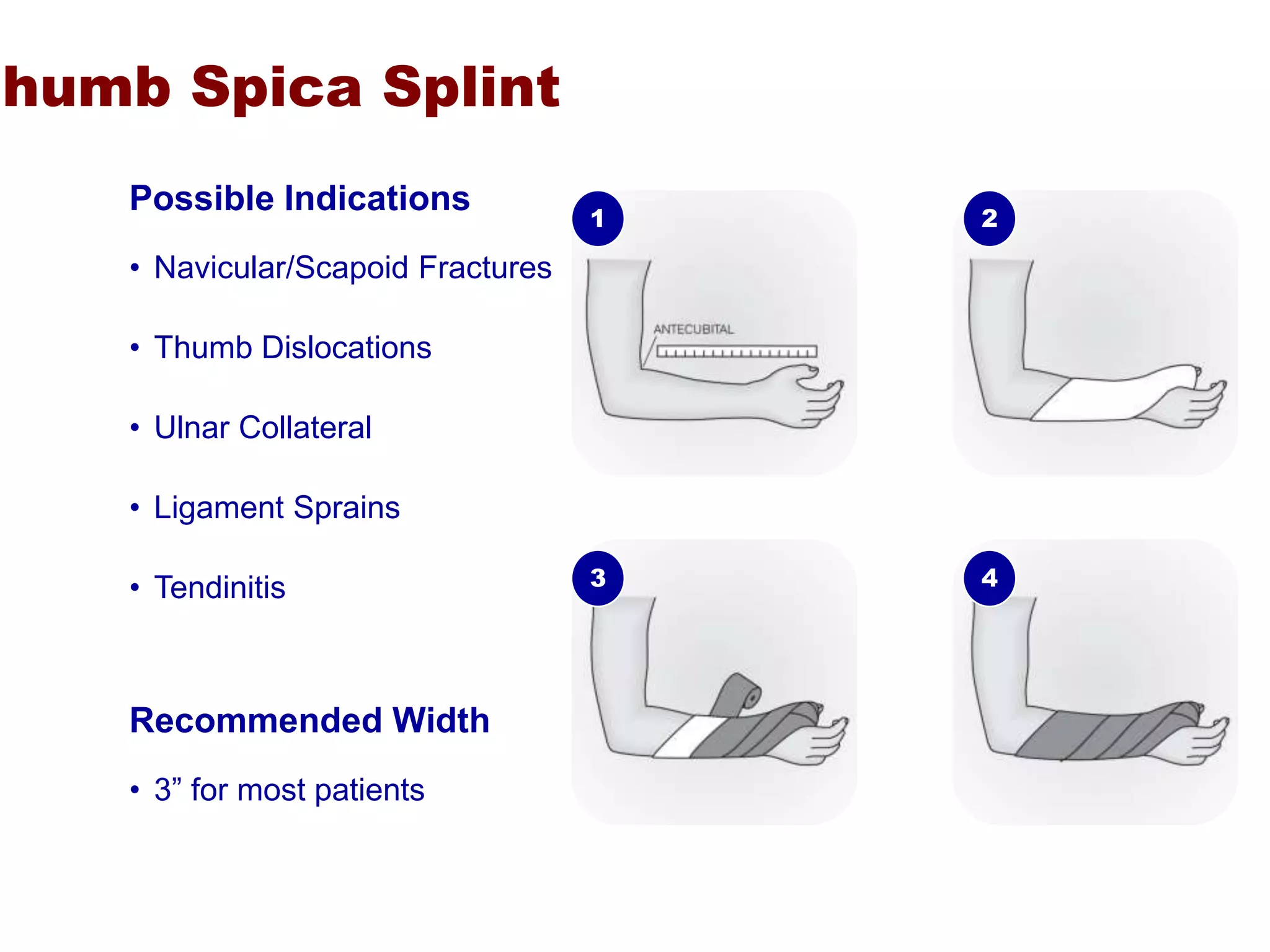 casting-splinting.ppt