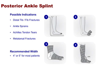 casting-splinting.ppt