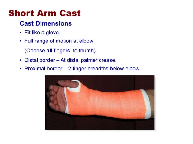 casting-splinting.ppt