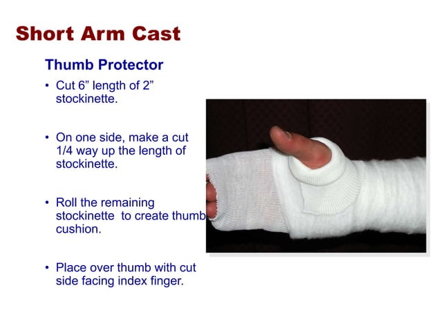 casting-splinting.ppt