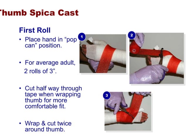 casting-splinting.ppt