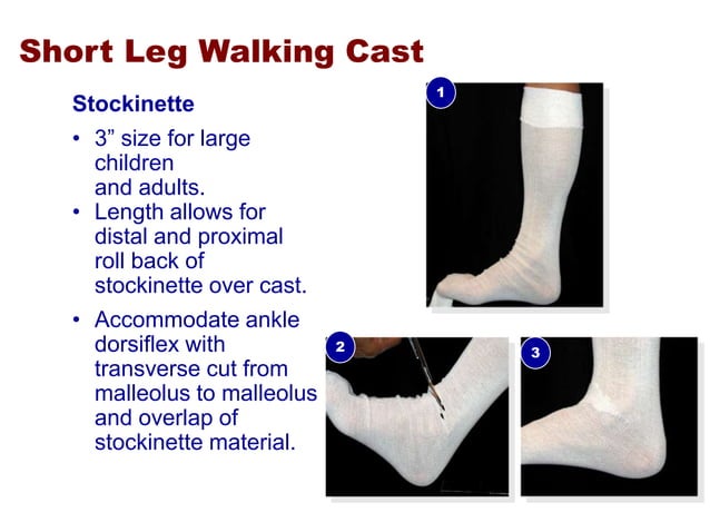 casting-splinting.ppt