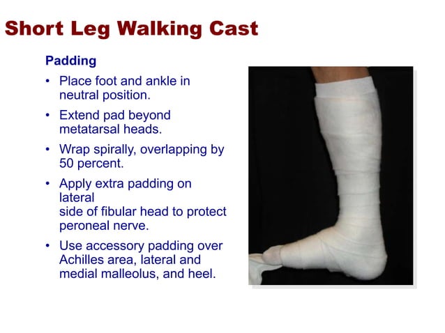 casting-splinting.ppt