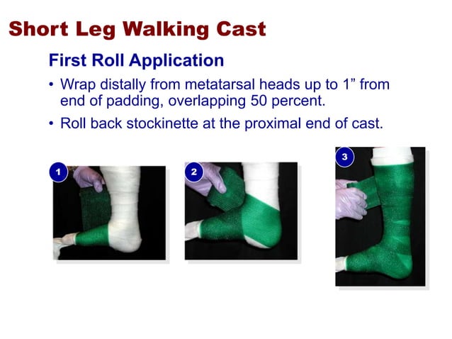 casting-splinting.ppt