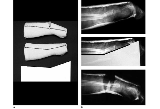 Casting and splinting principles and common pitfalls | PPT | First Aid ...