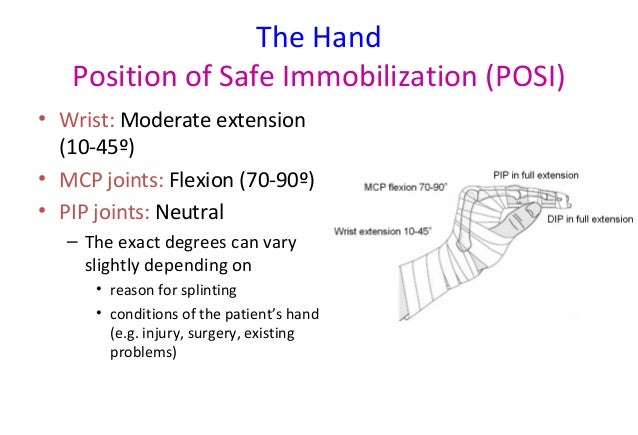 Casting and splinting principles and common pitfalls