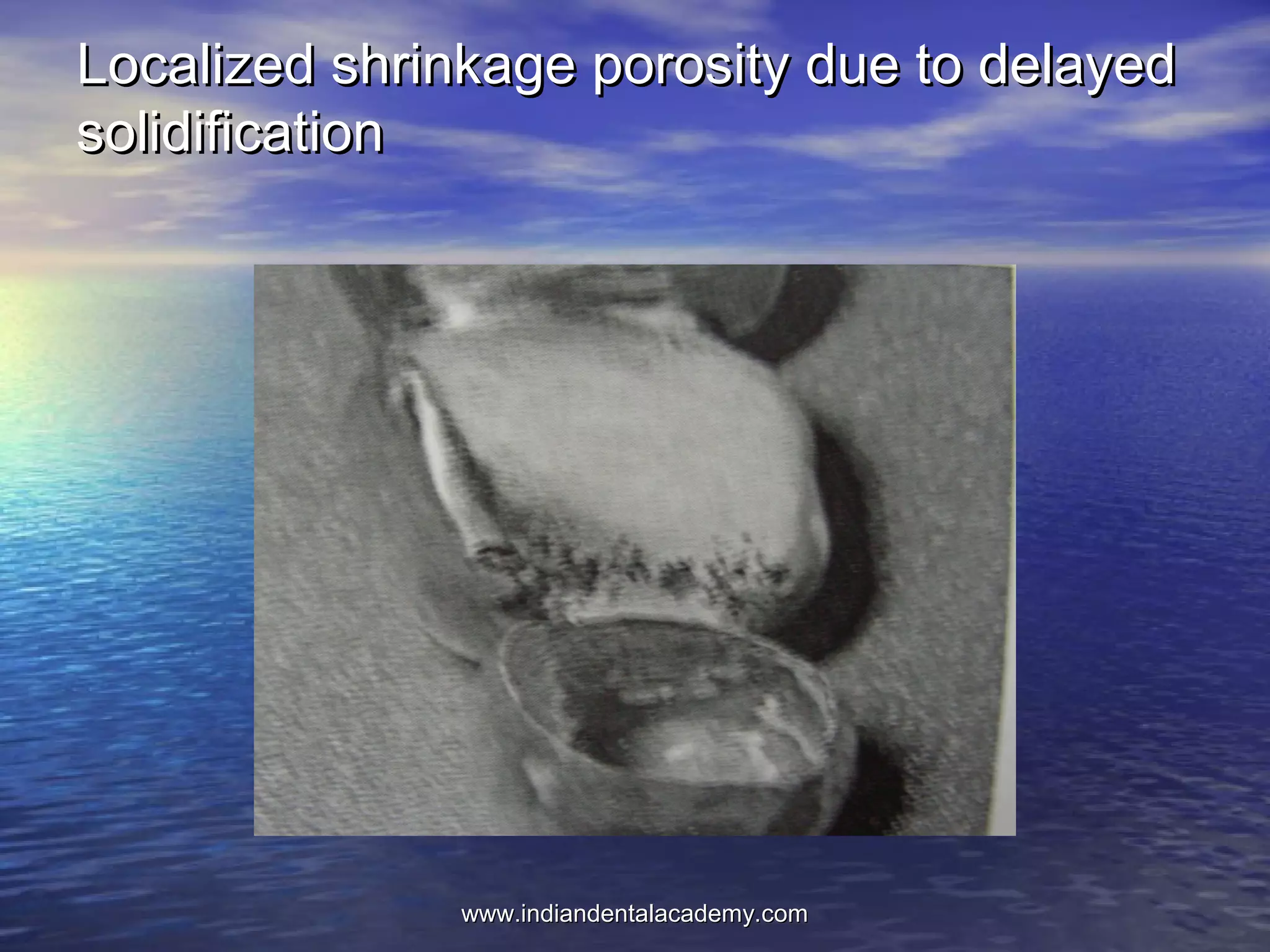 dental Casting defects/prosthodontic courses | PPT | Science