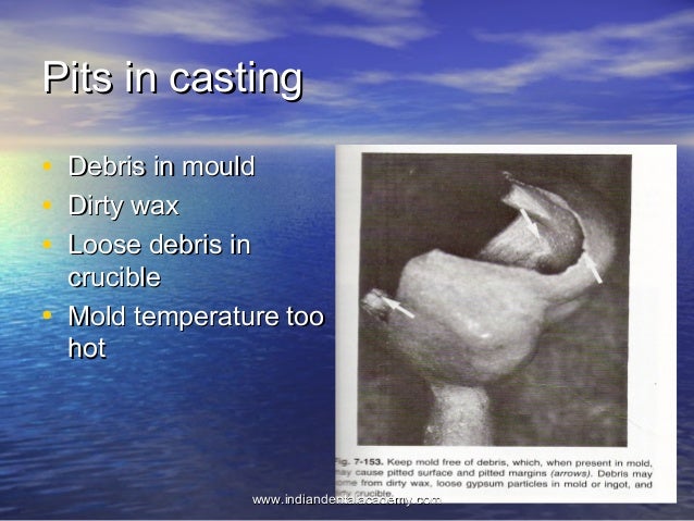 dental Casting defects/prosthodontic courses
