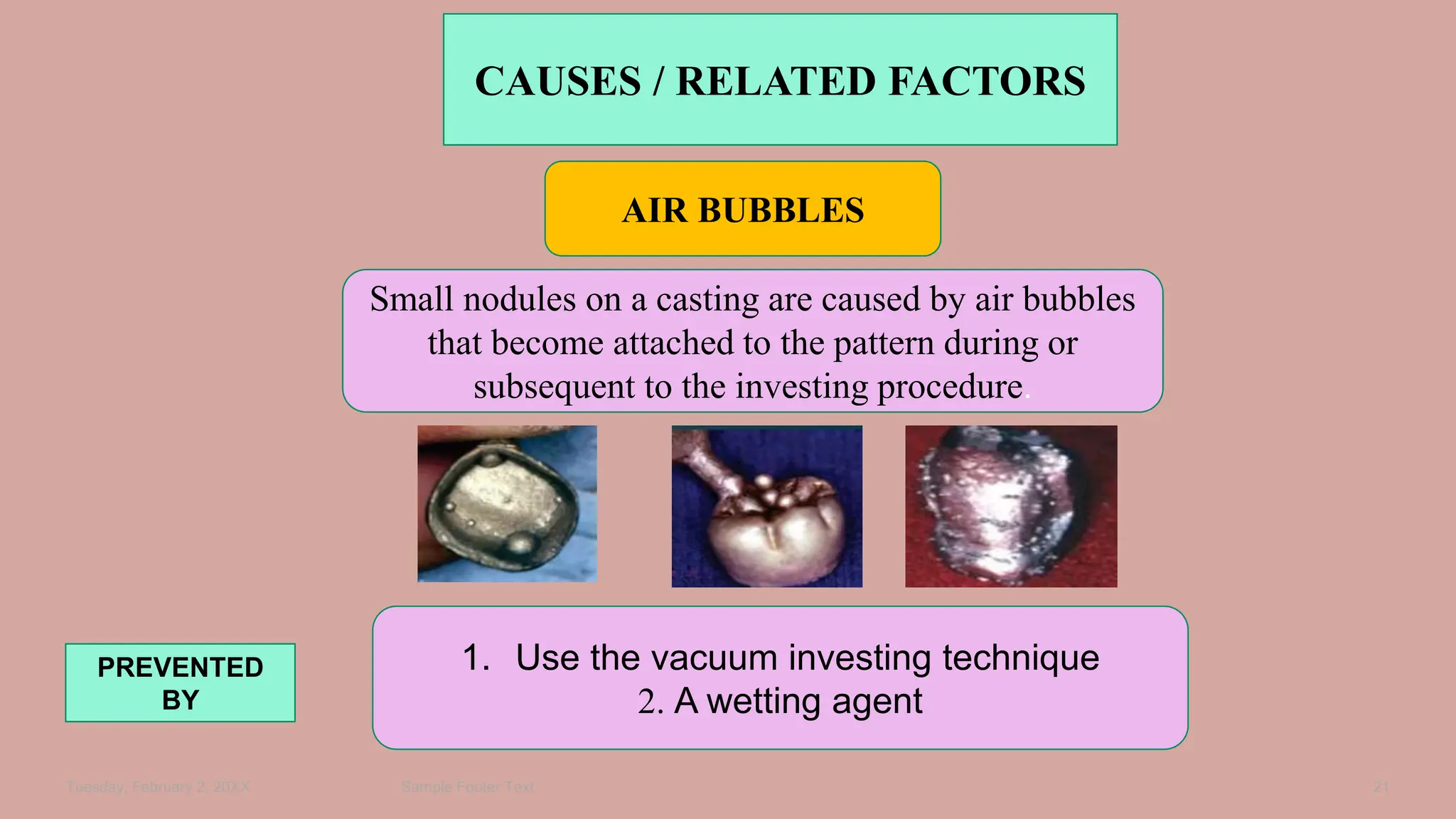 Casting defects in dentistry | PPTX
