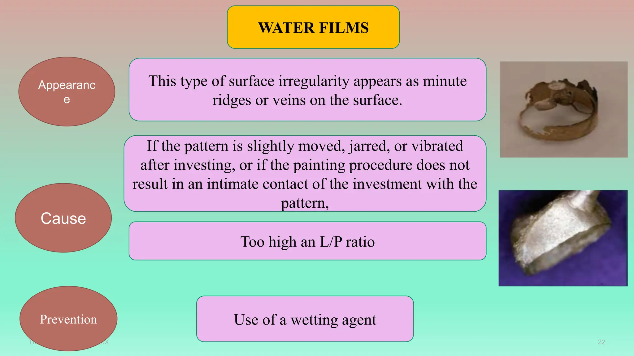 Casting defects in dentistry | PPTX