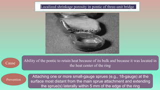 Casting defects in dentistry | PPTX