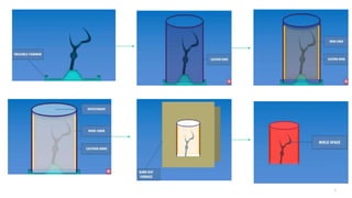 Casting defects in dentistry | PPTX