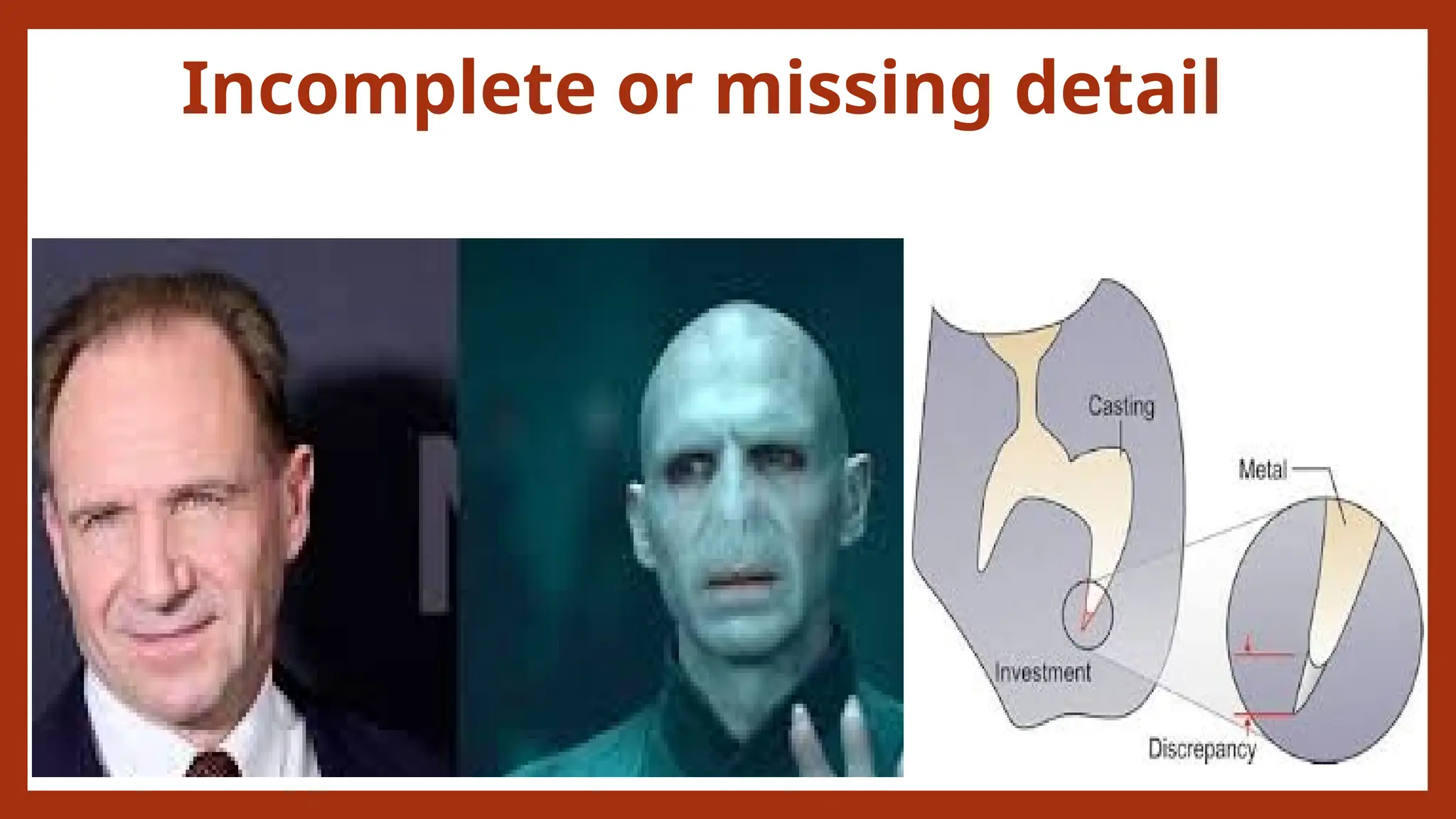 Dental Casting Defects - Dental Materials | PPTX