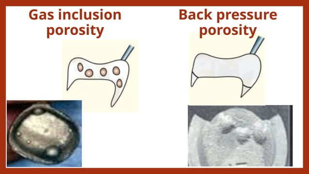 Dental Casting Defects - Dental Materials | PPT