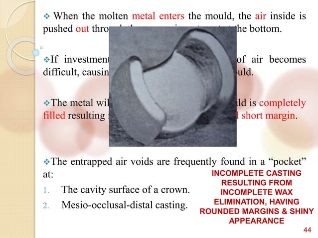 Casting defects in dentistry | PPTX | Candle and Soap Making | Arts and ...