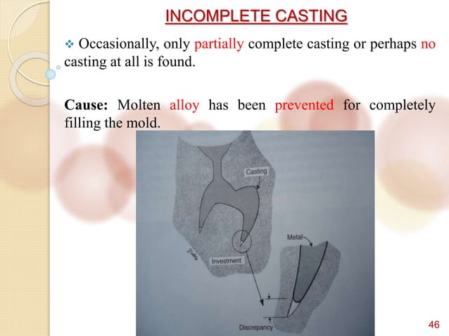 Casting defects in dentistry | PPTX | Candle and Soap Making | Arts and ...