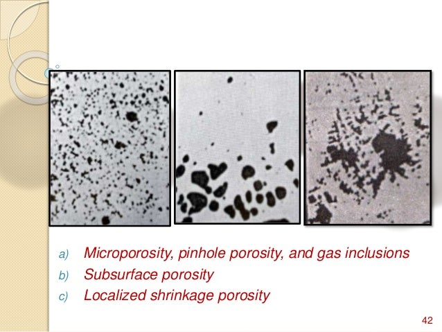 Casting defects in dentistry