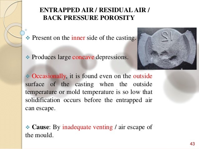 Casting defects in dentistry