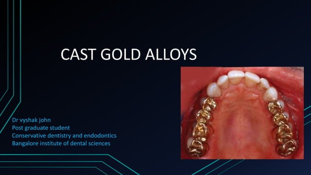 Casting gold alloys | PPTX