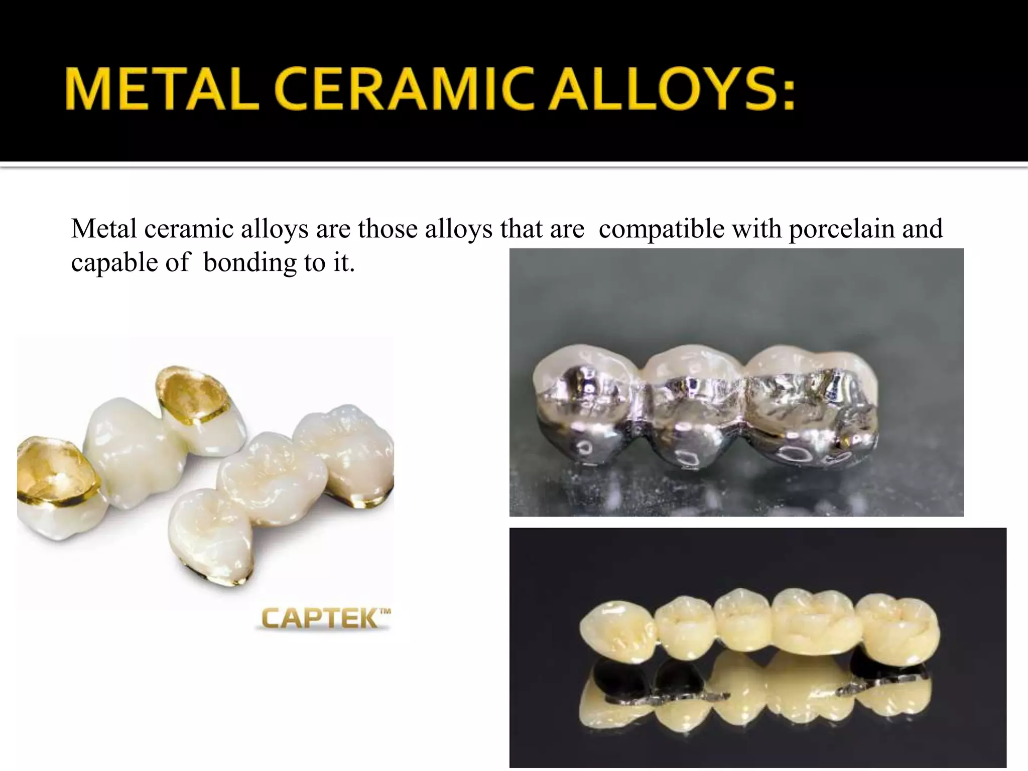 Dental Casting alloys | PPTX