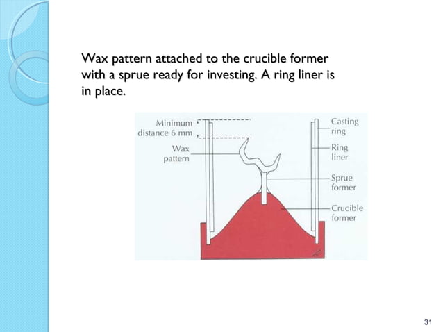 Casting procedures in dentistry | PPT | Jewelry Making | Arts and Crafts