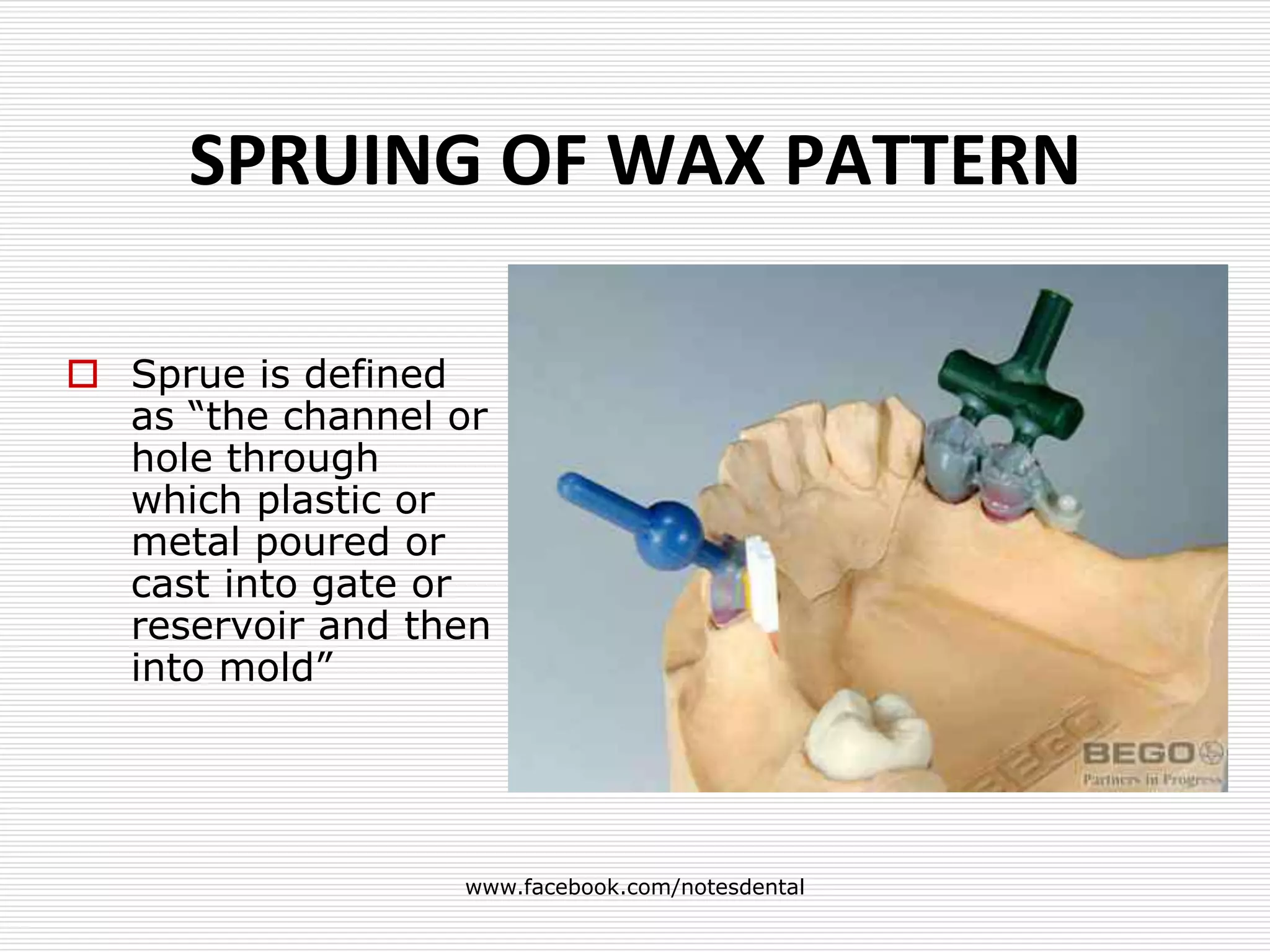 Casting procedure | PPTX