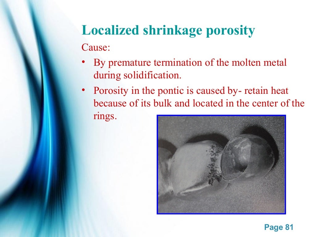 Casting Defects Classification