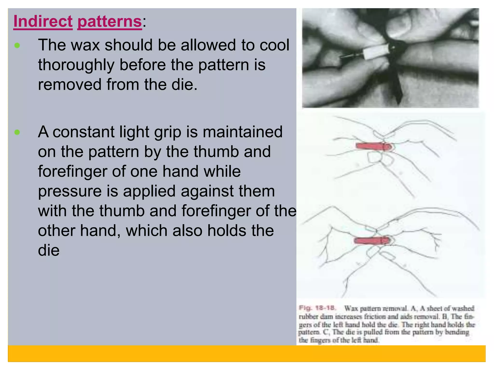 Casting procedures | PPTX