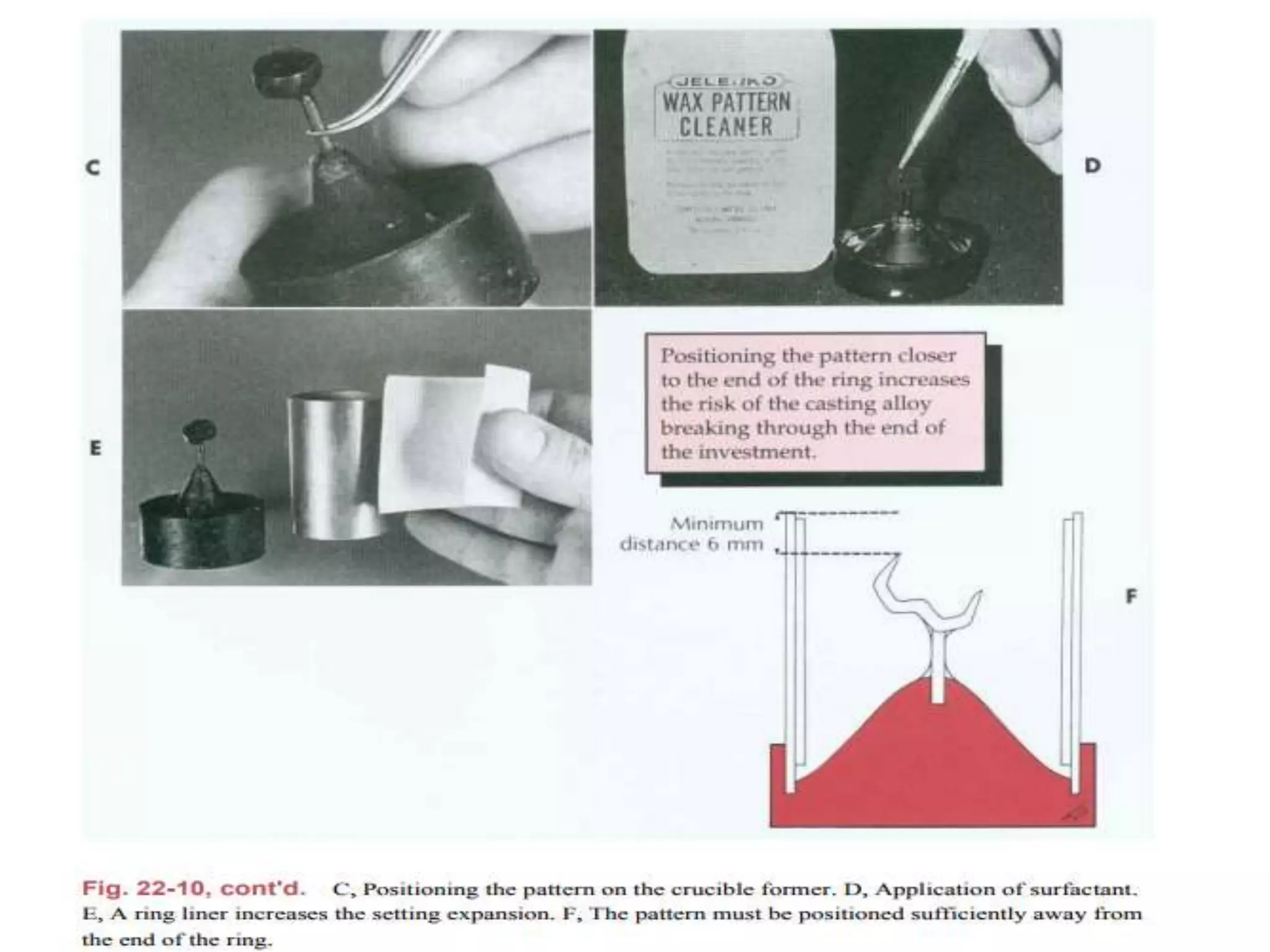 Casting procedures | PPTX