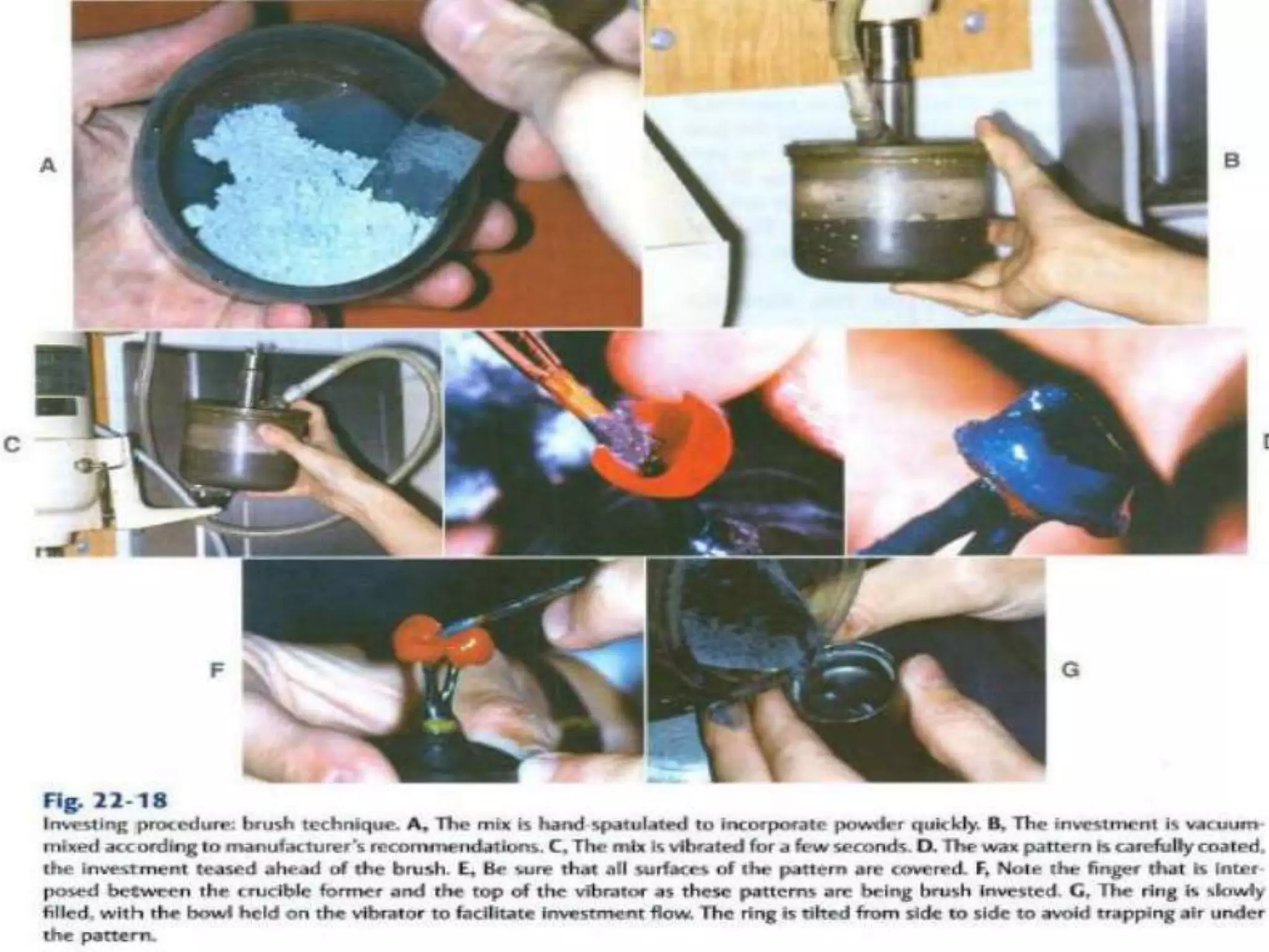 Casting procedures | PPTX