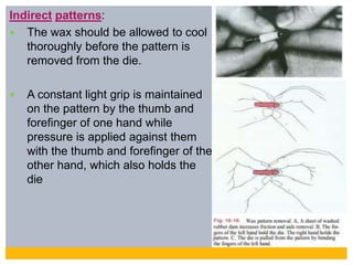 Casting procedures | PPTX