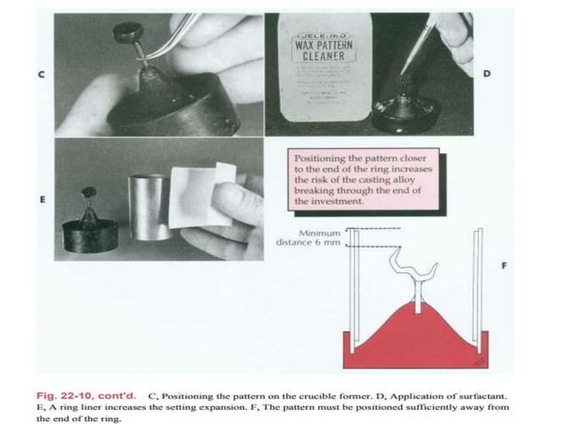 Casting procedures | PPTX