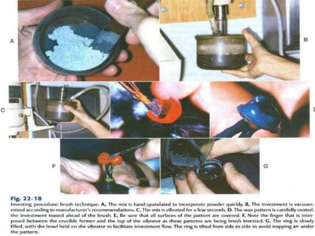 Casting procedures | PPTX