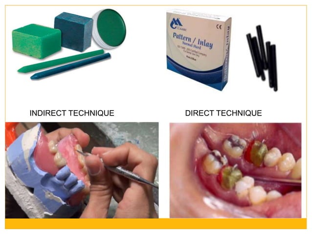 Casting procedures | PPTX