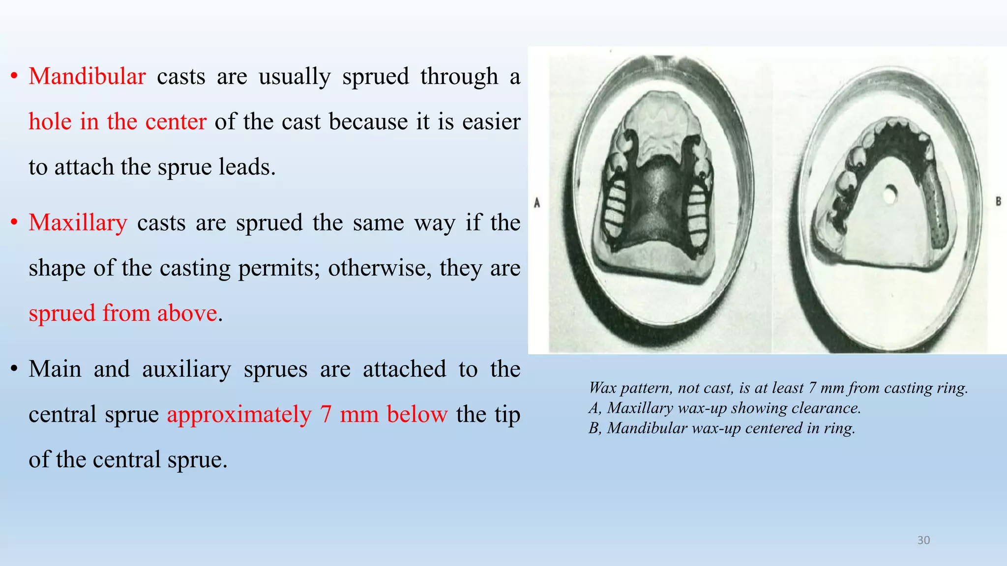 Casting Procedures & Casting Defects in Dentistry | PPTX