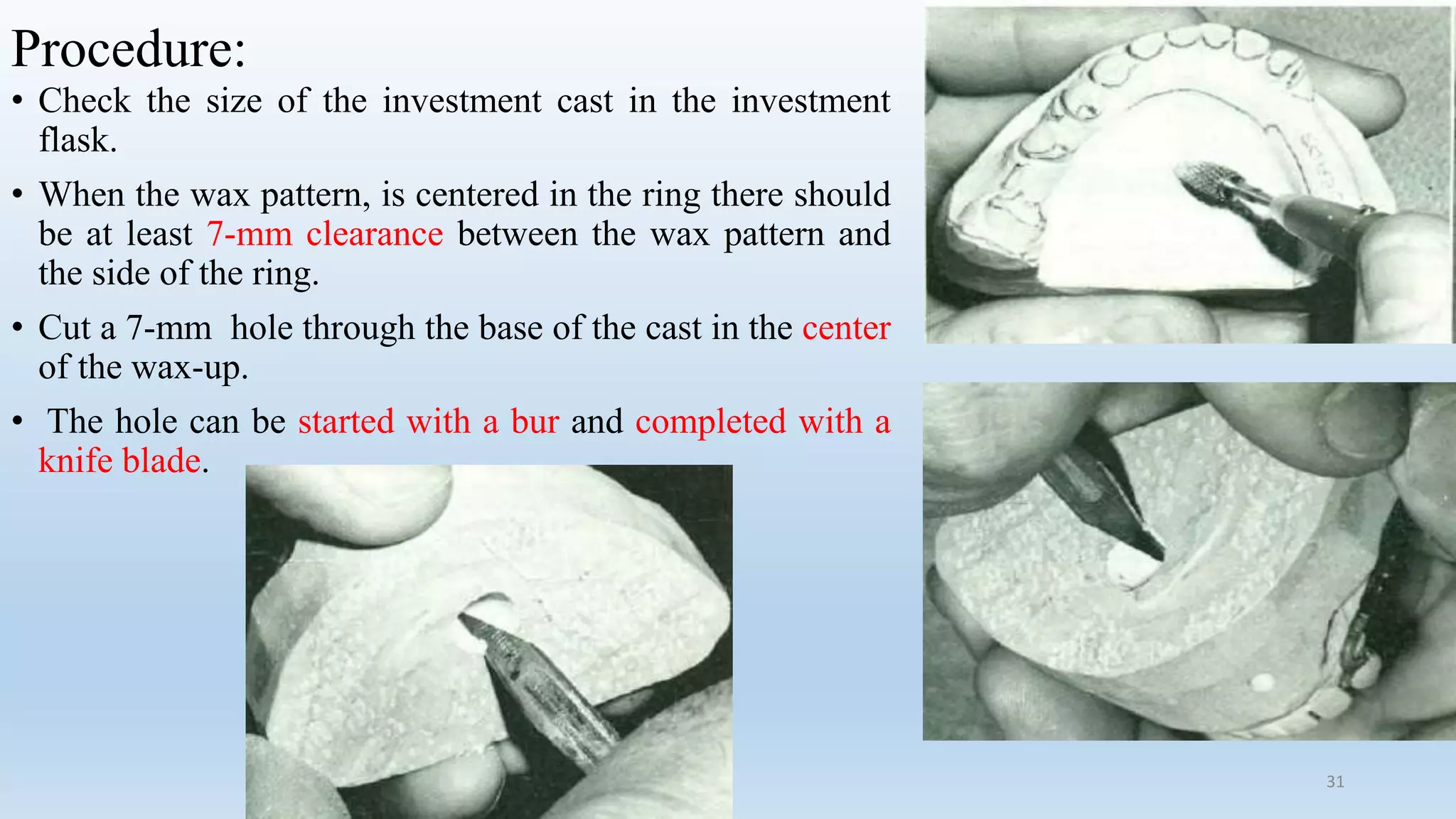 Casting Procedures & Casting Defects in Dentistry | PPTX
