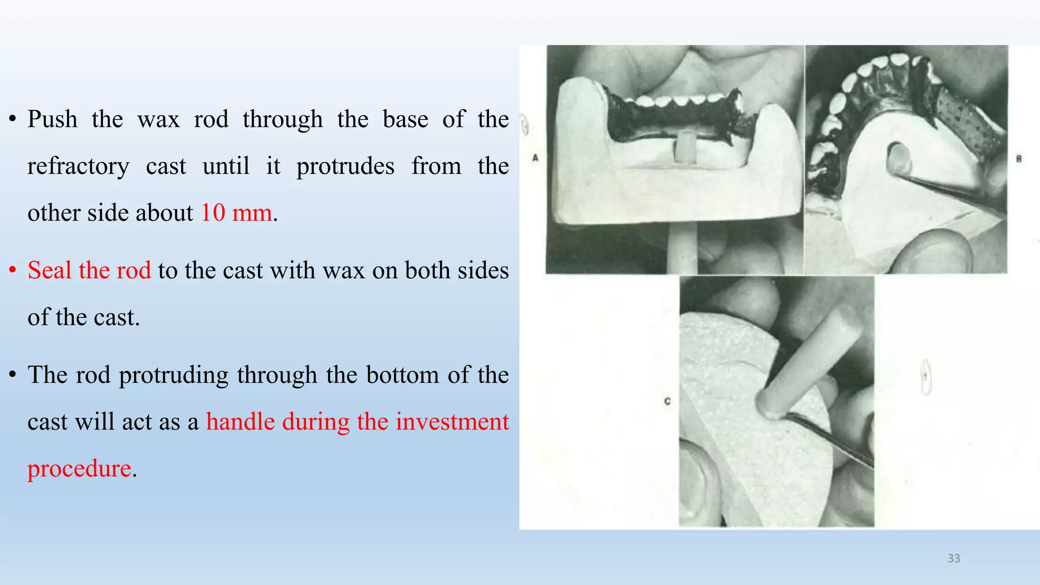 Casting Procedures & Casting Defects in Dentistry | PPTX