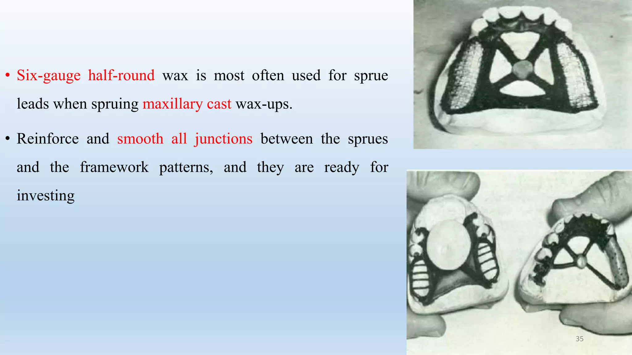 Casting Procedures & Casting Defects in Dentistry | PPTX