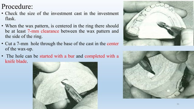 Casting Procedures & Casting Defects in Dentistry | PPTX | Jewelry ...