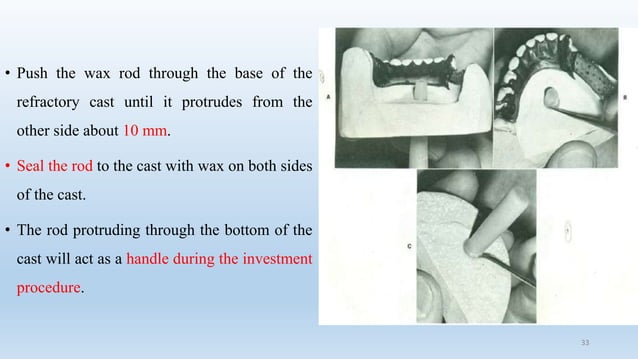 Casting Procedures & Casting Defects in Dentistry | PPTX | Jewelry Making | Arts and Crafts