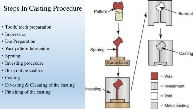 Casting Procedures & Casting Defects in Dentistry